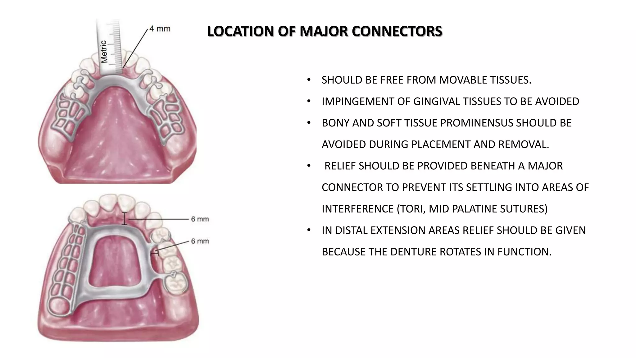Major and Minor Connectors | PPTX