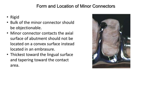 Major and Minor Connectors | PPTX | Oral care | Personal Care