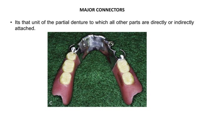 Major and Minor Connectors | PPTX | Oral care | Personal Care