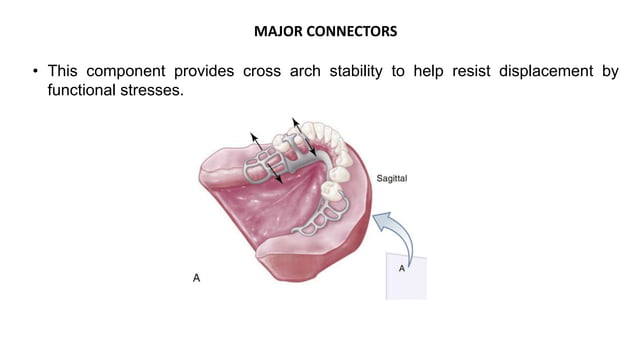 Major and Minor Connectors | PPTX | Oral care | Personal Care