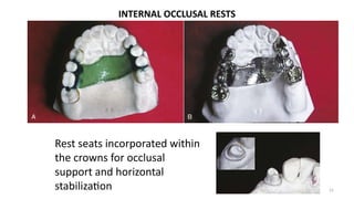 McCracken's Chapter 6 Rest and Rest Seats | PPTX