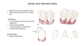 McCracken's Chapter 6 Rest and Rest Seats | PPTX