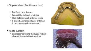 McCracken's Chapter 8 Indirect Retainers | PPT