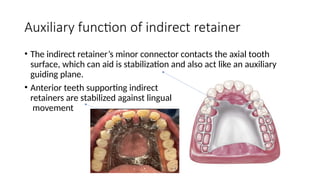 McCracken's Chapter 8 Indirect Retainers | PPTX