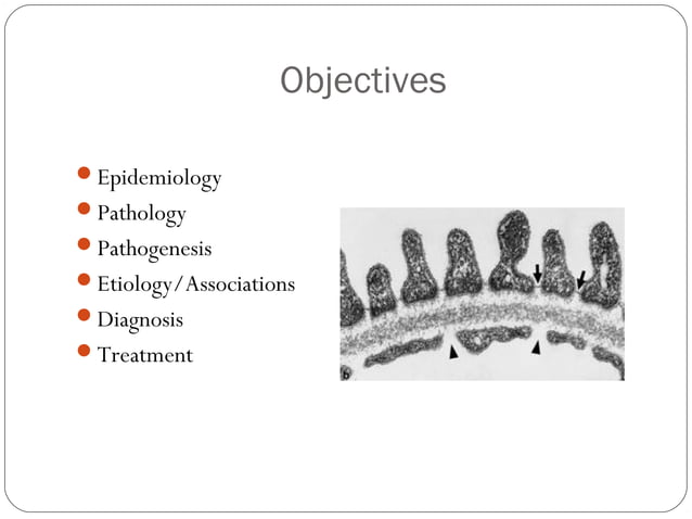 Minimal Change Disease | PPT
