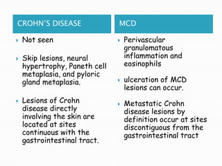 Metastatic Crohn Disease | PPTX