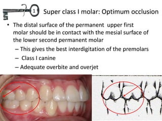 Orthodontics-Periodontics | PPTX