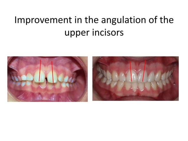 Orthodontics-Periodontics | PPT
