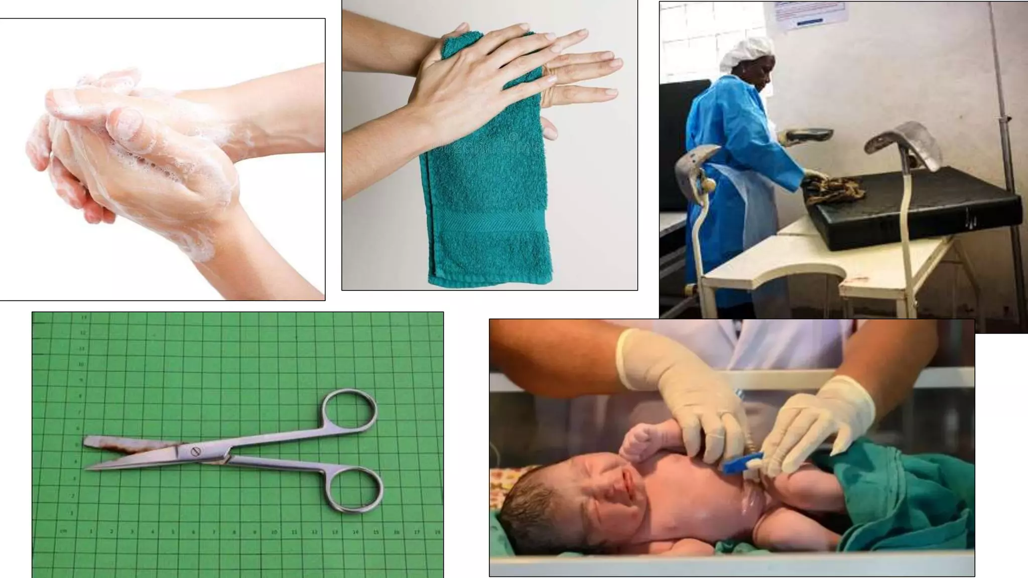 Mch3 Postnatal care (PNC) and the newborn baby | PPTX