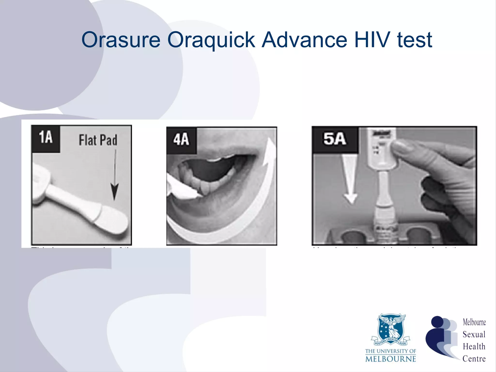 Rapid testing for syphilis and HIV | PPT