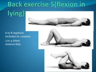 Mckenzie Extension Exercises