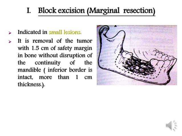 Tumors - part 1 and biology for the seco | PPT