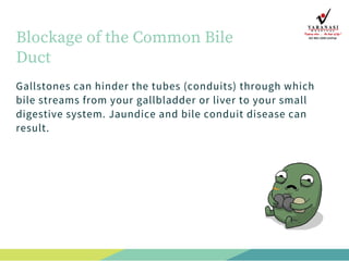 Gallstones - Symptoms & Causes | PDF