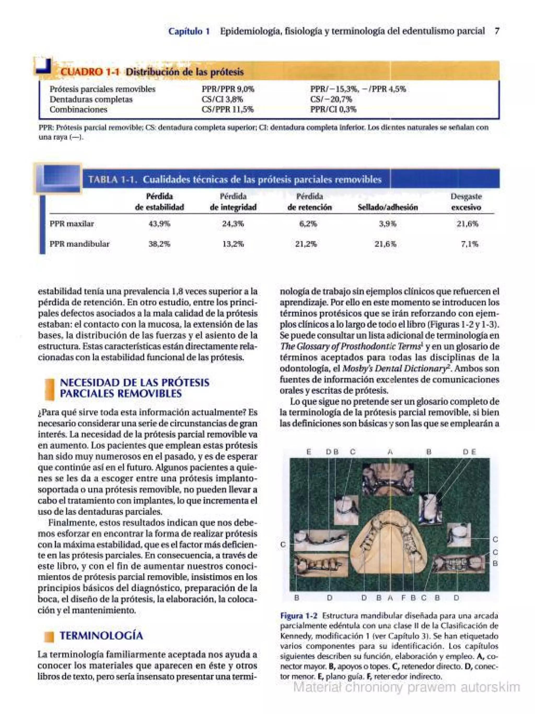 Prótesis Parcial Removible- Mckraken | PDF