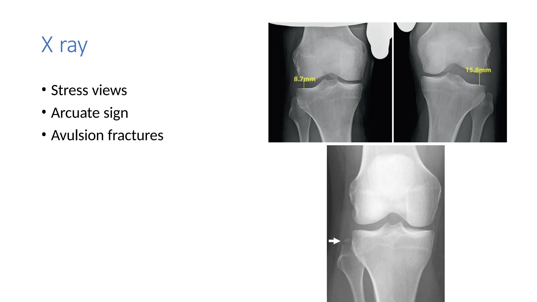 mcllclall-191018124031.pptx. . | PPTX