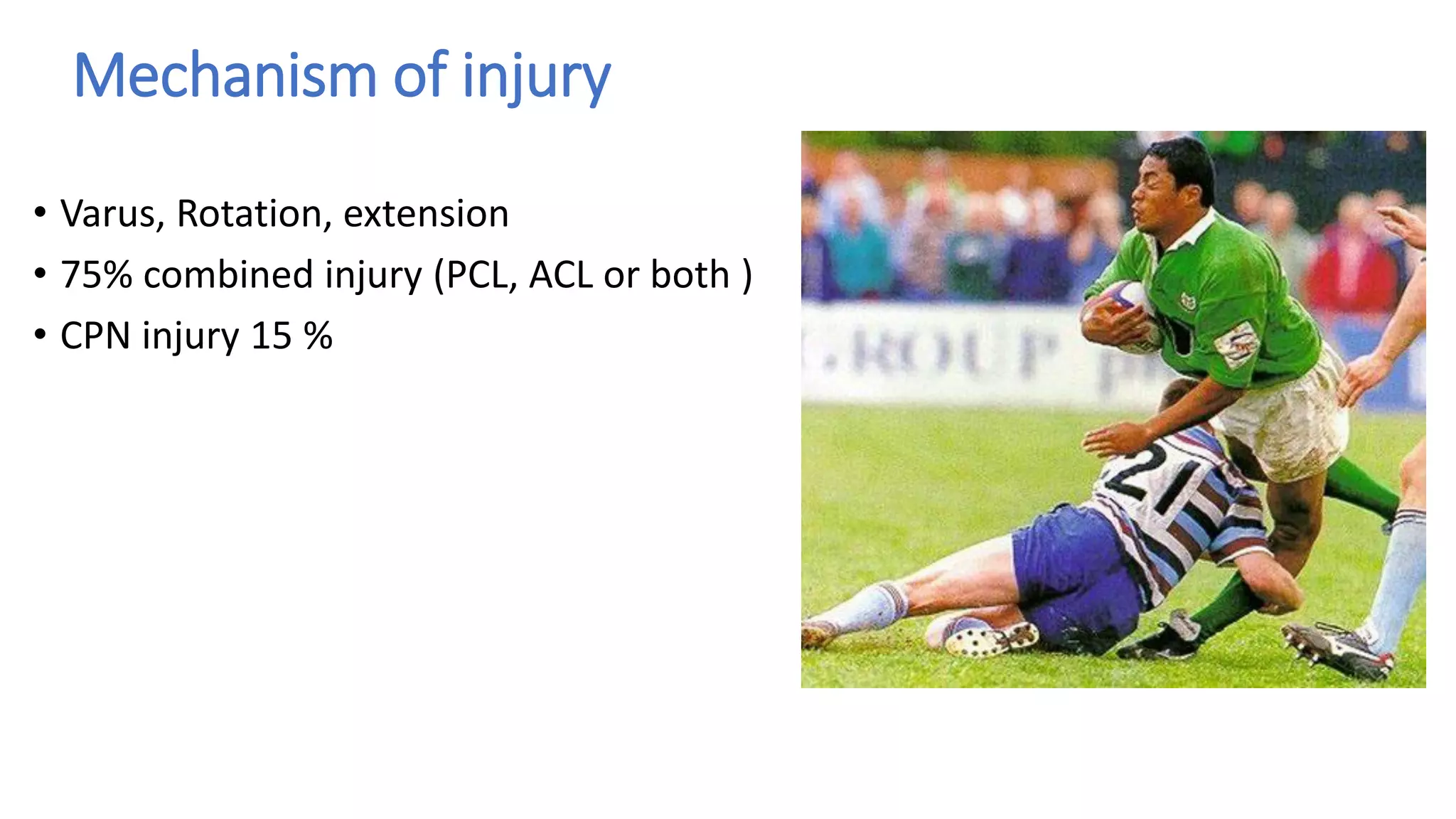 MCL,LCL & ALL injuries of the knee | PDF