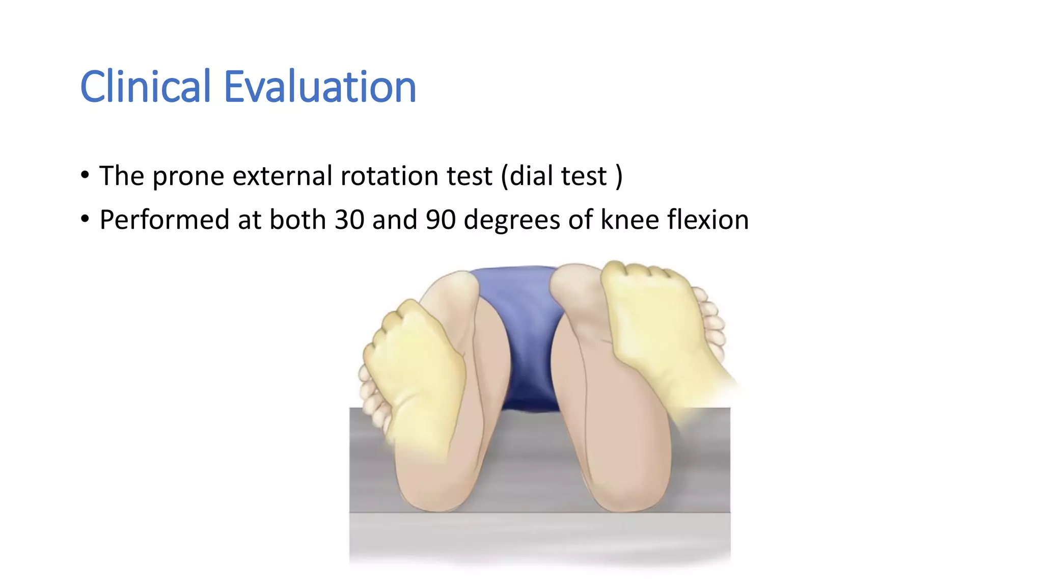 MCL,LCL & ALL injuries of the knee | PDF