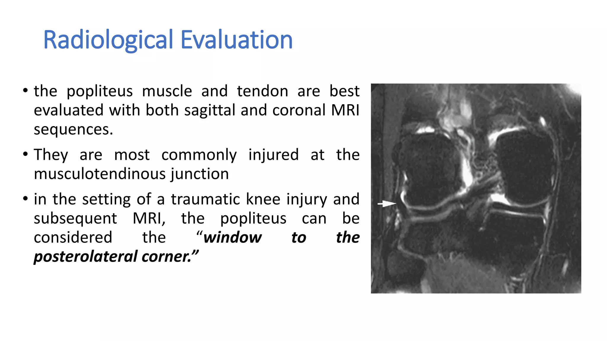 MCL,LCL & ALL injuries of the knee | PDF