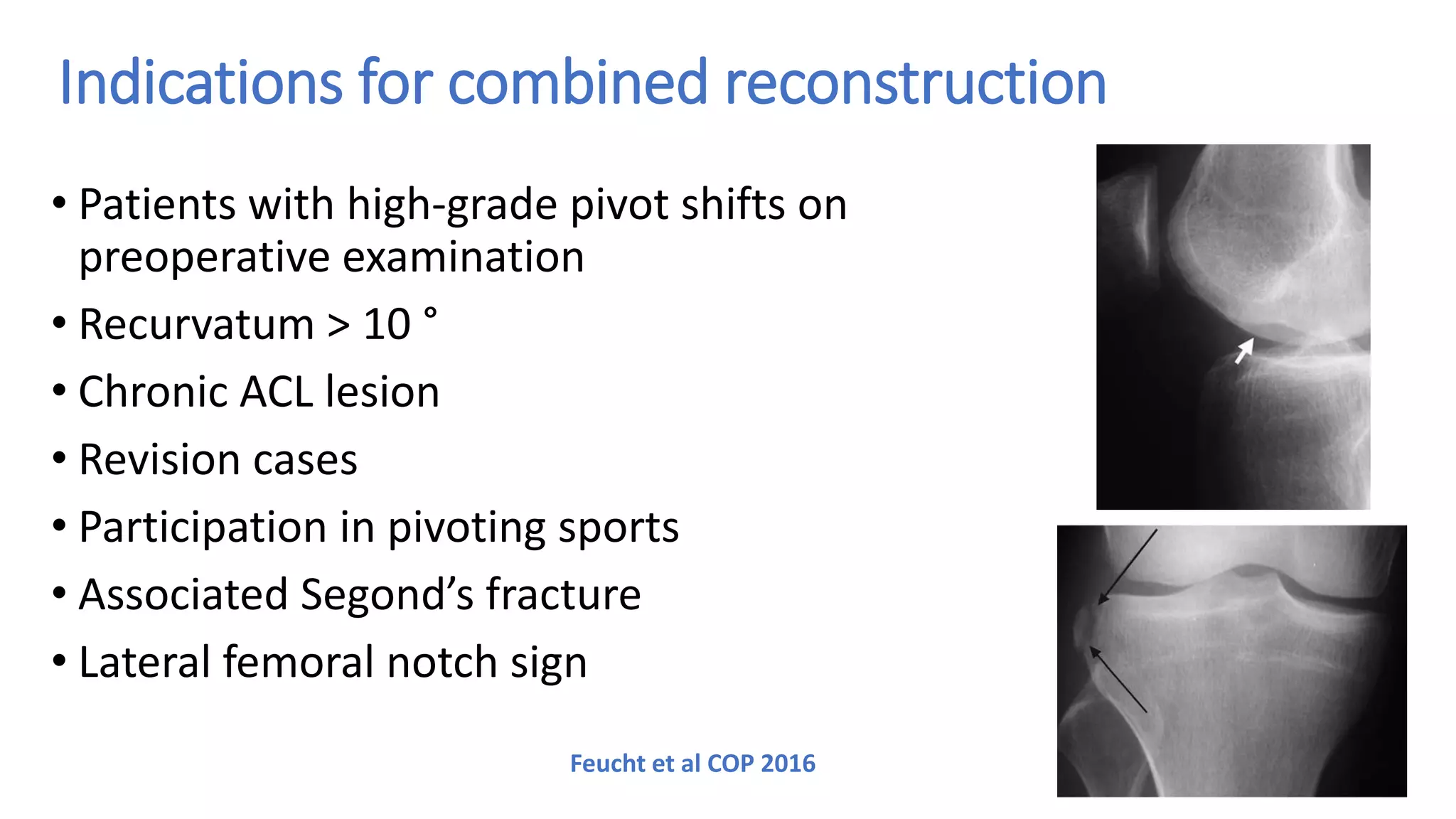 MCL,LCL & ALL injuries of the knee | PDF