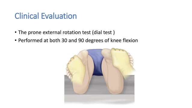 MCL,LCL & ALL injuries of the knee | PDF