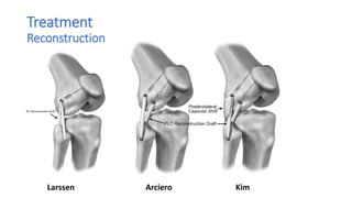 MCL,LCL & ALL injuries of the knee | PDF
