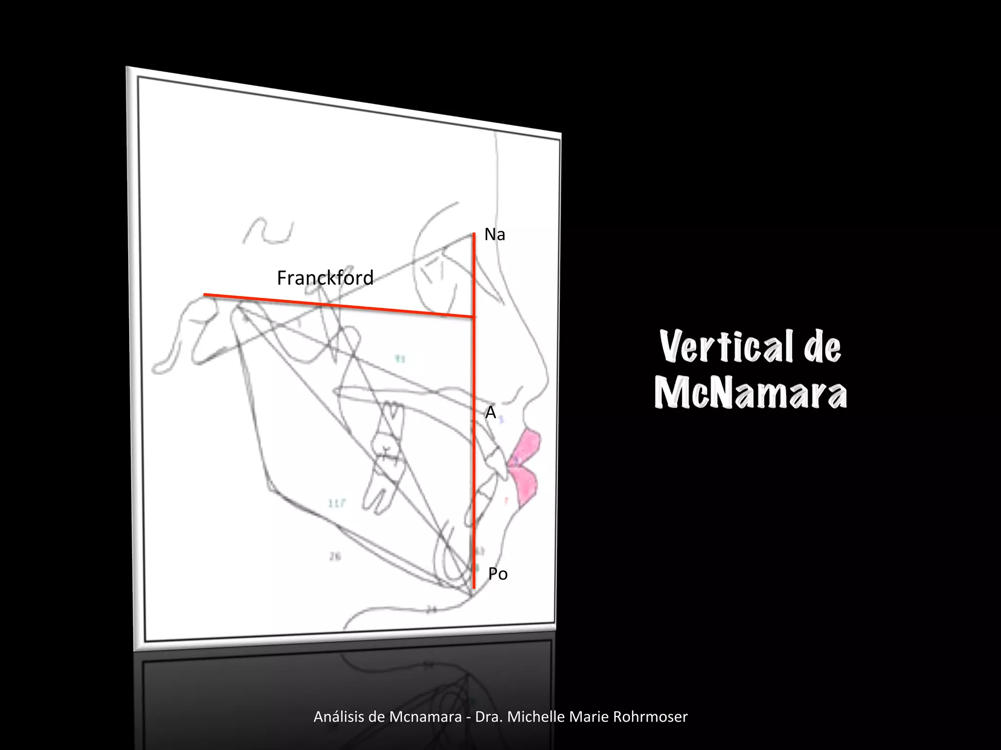Análisis de Mcnamara | PDF