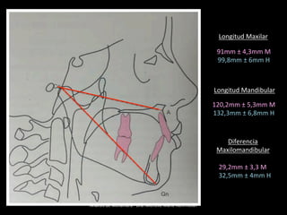 Análisis de Mcnamara | PPT