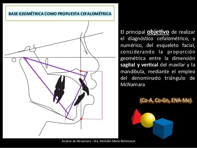 Análisis de Mcnamara