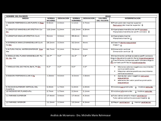 Análisis de Mcnamara