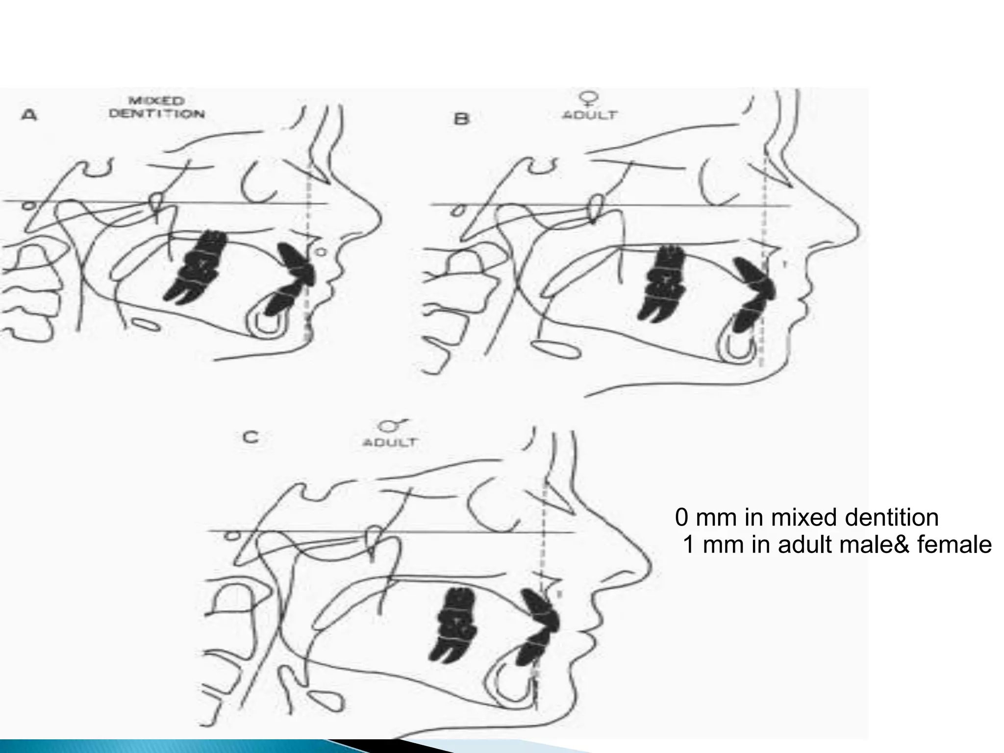 Mc namara analysis | PPTX