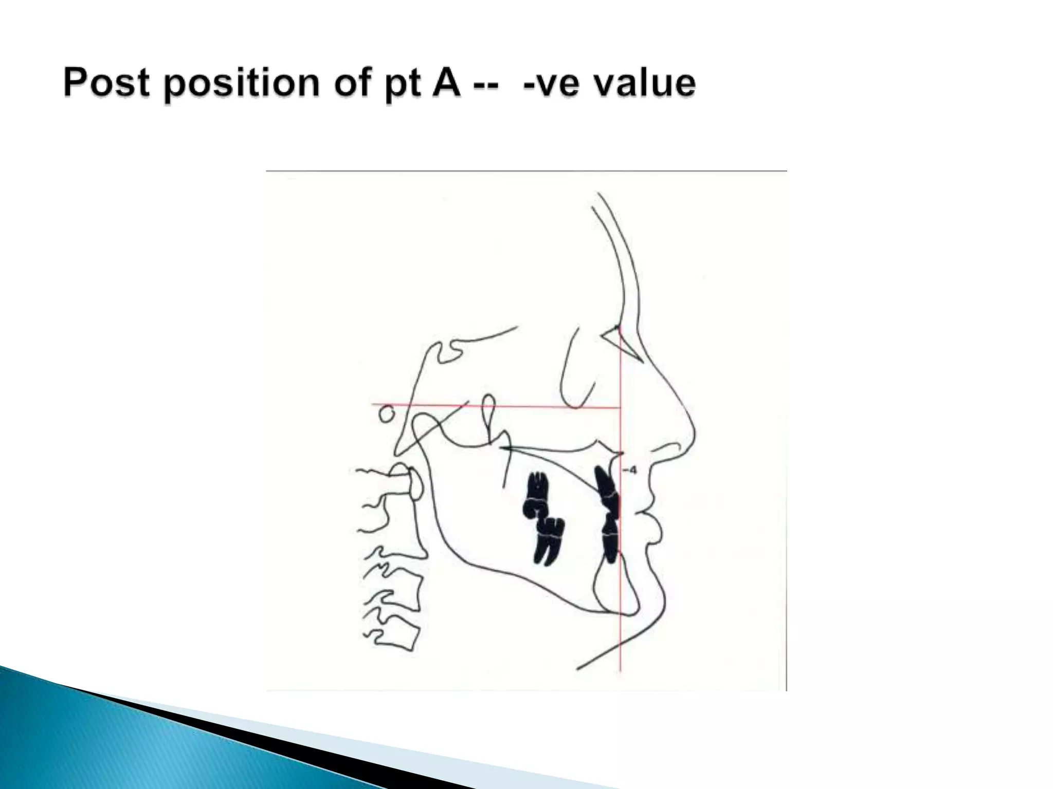 Mc namara analysis | PPTX