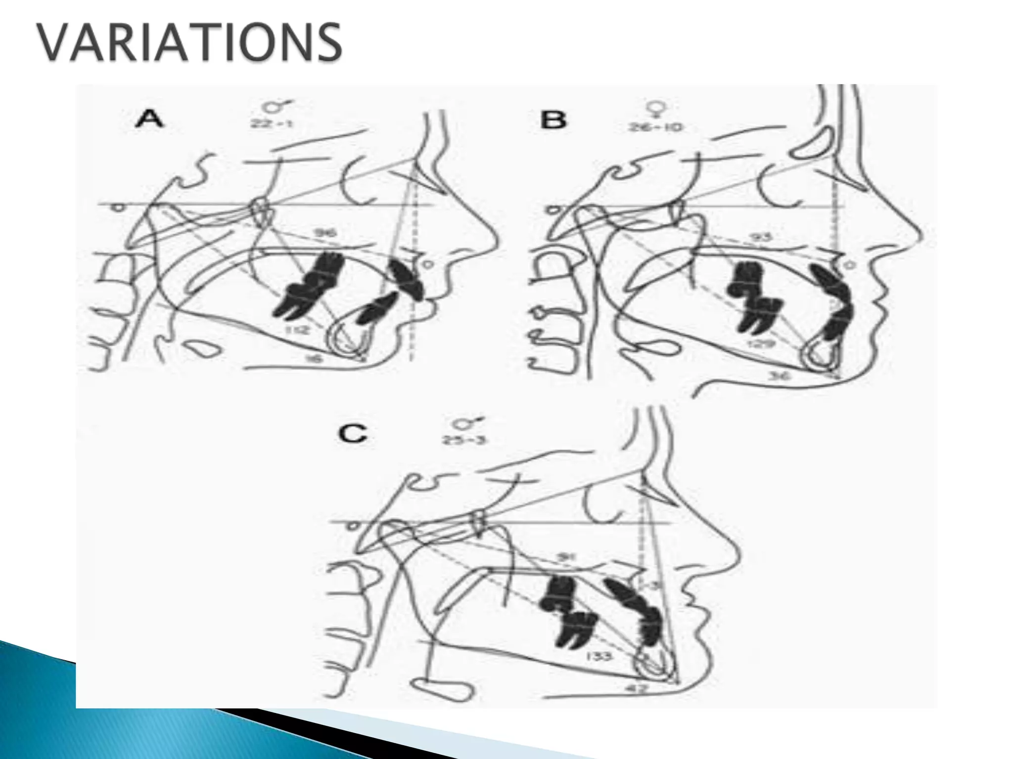 Mc namara analysis | PPTX