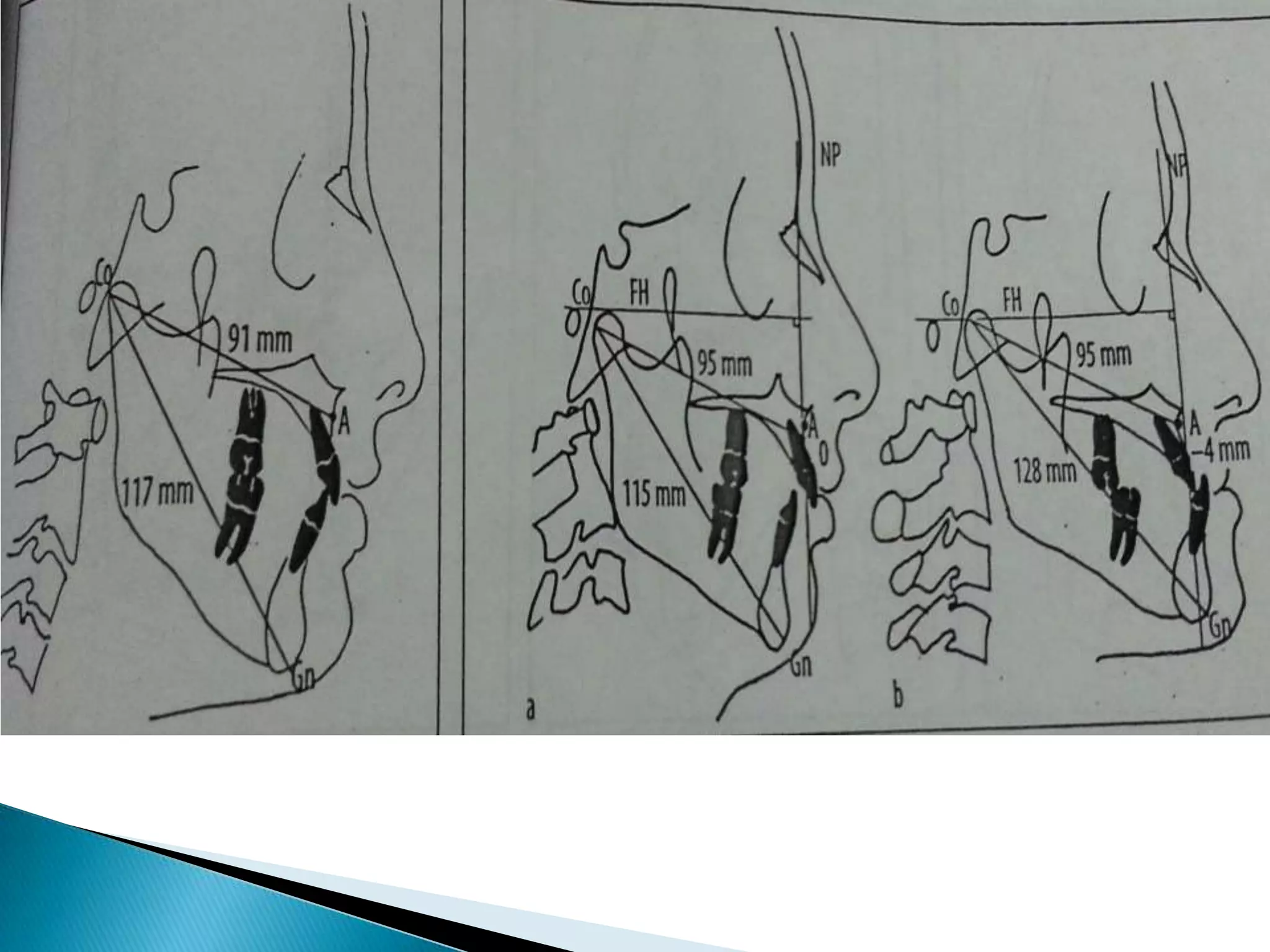 Mc namara analysis | PPTX