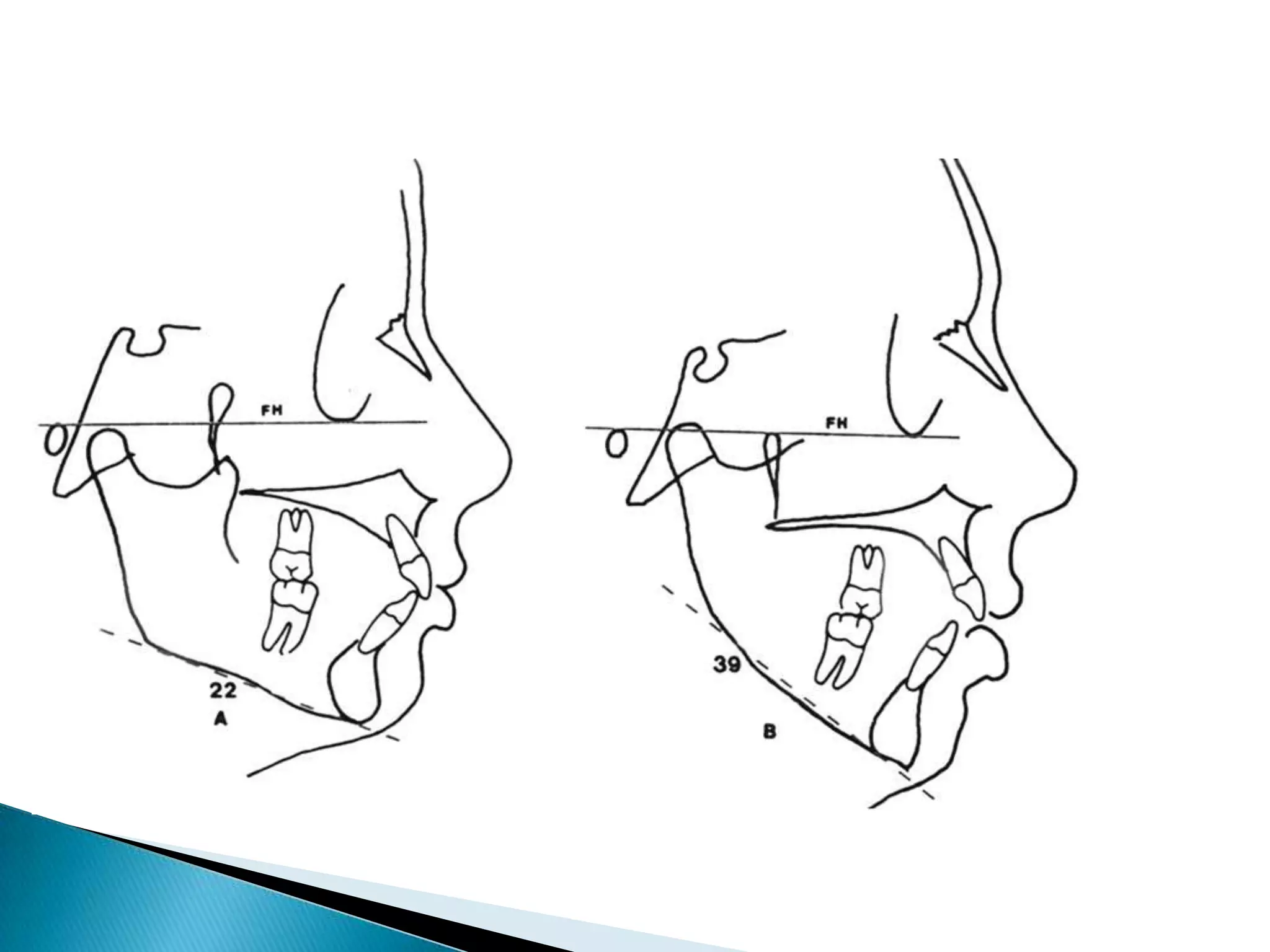 Mc namara analysis | PPTX