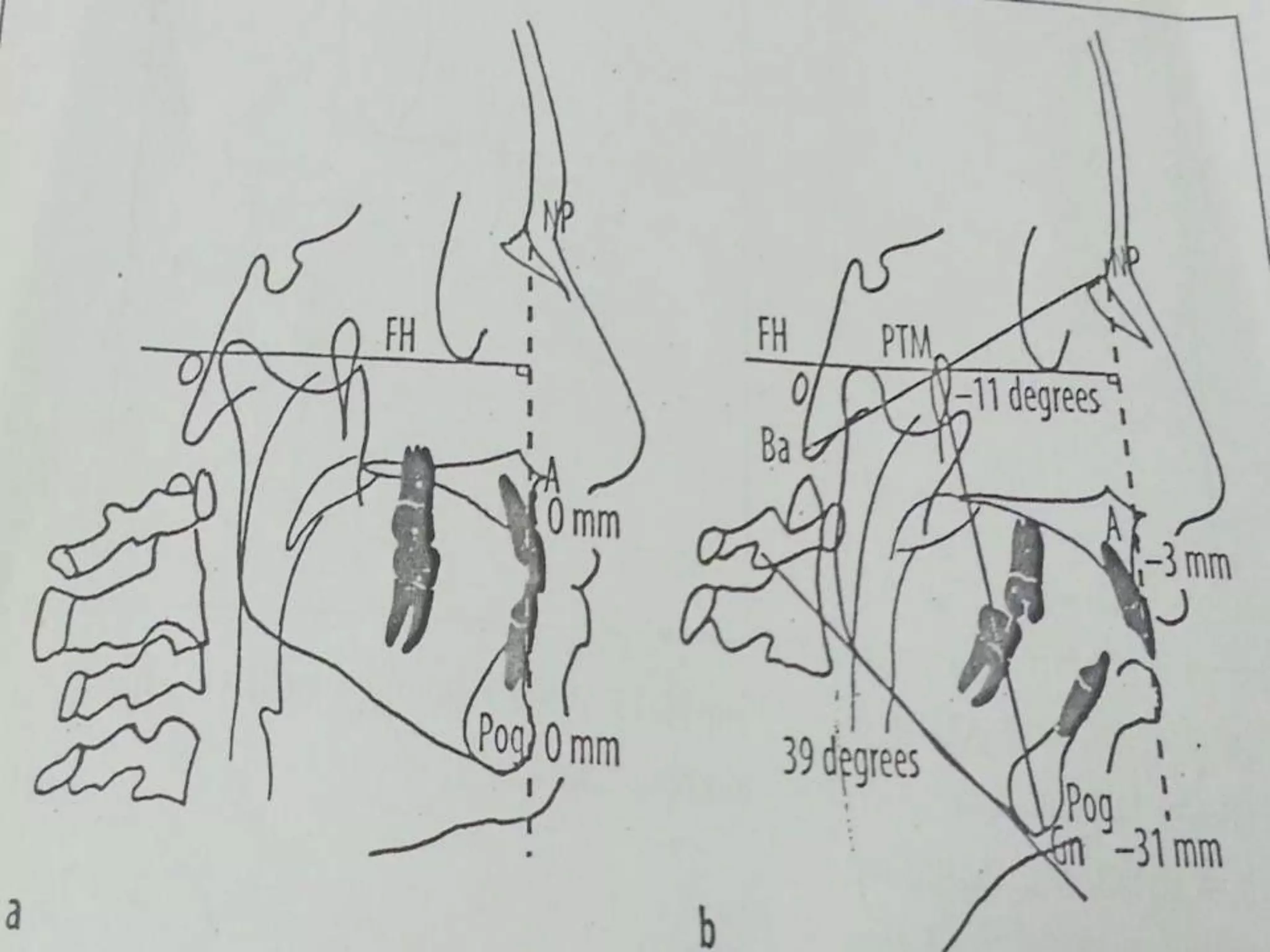 Mc namara analysis | PPTX