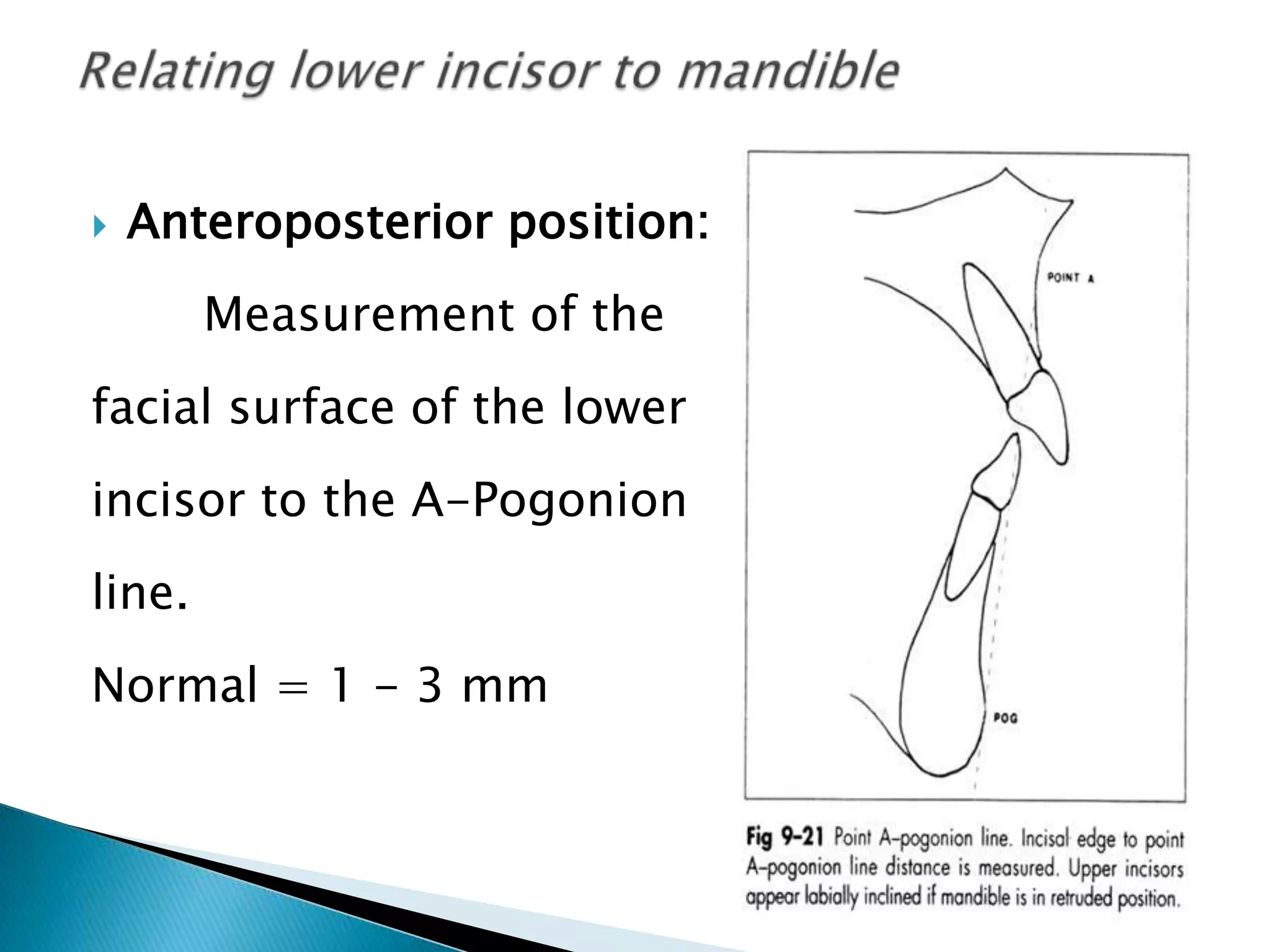 Mc namara analysis | PPTX