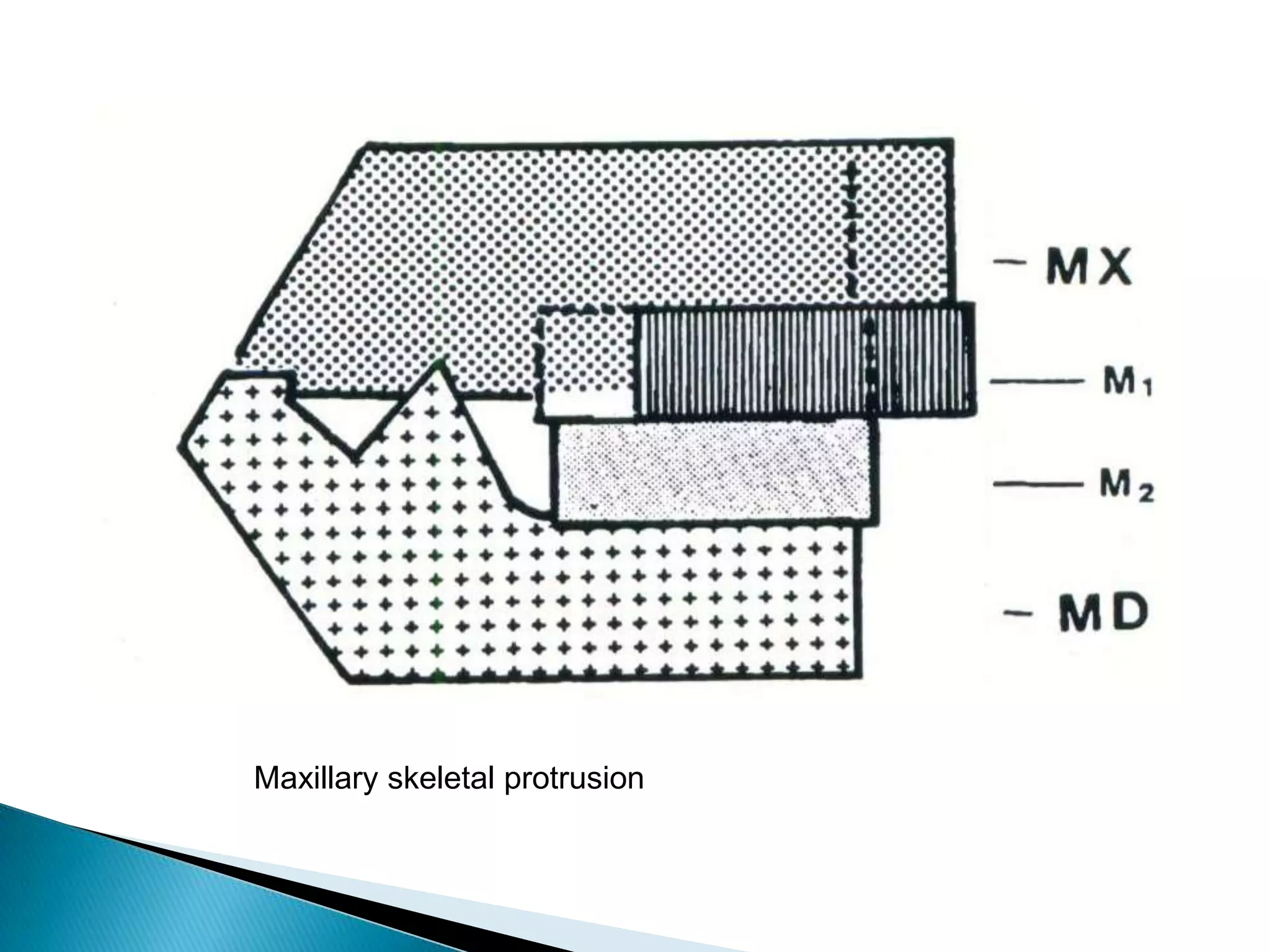 Mc namara analysis | PPTX