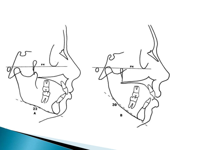 Mc namara analysis | PPTX