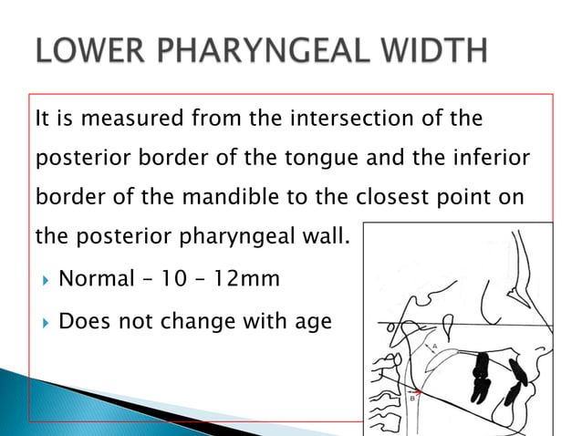 Mc namara analysis | PPTX