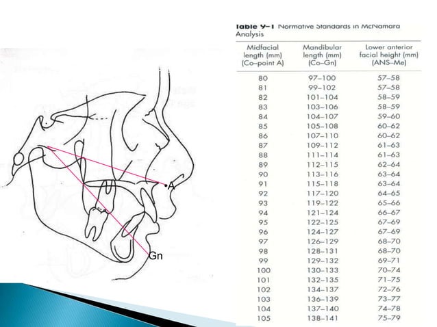 Mc namara analysis | PPT