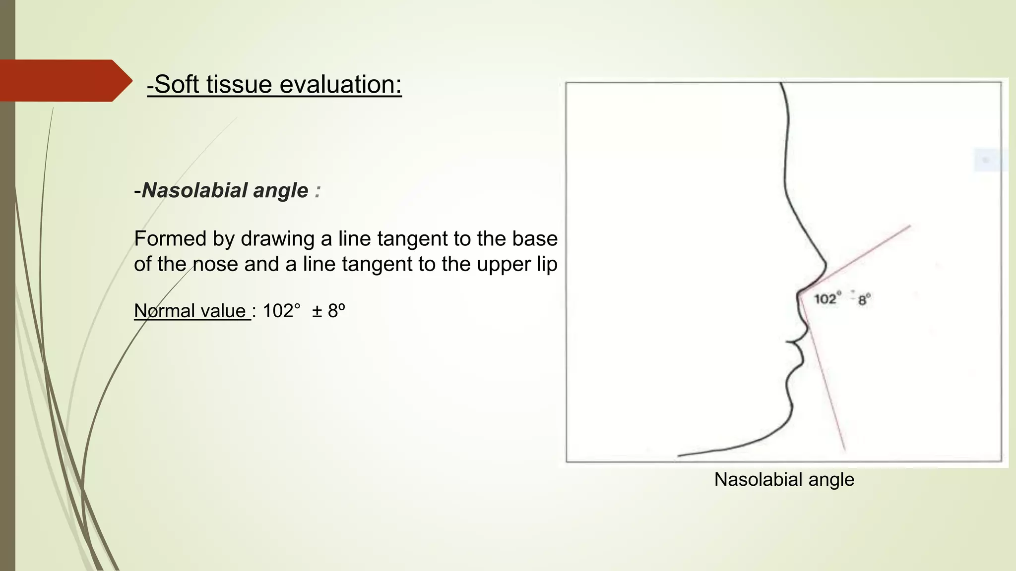Mc namara analysis | PPTX