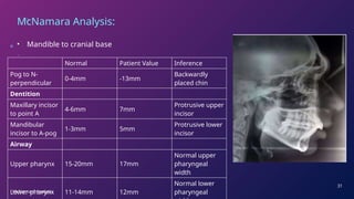 McNamara Orthodontic Cephalometric Analysis.pptx