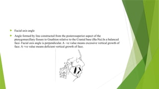 mcnamaras analysis in orthodontic ceh analysis | PPT