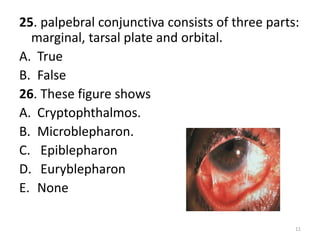 MCQ of ophthalmology(eyelids) | PPTX
