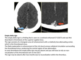 MCQ Chall_Gr_CVST cerebral venous thrombosis .pptx