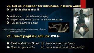 MCQ in burns with pictures | PPTX