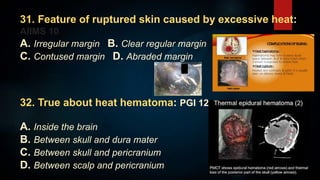 MCQ in burns with pictures | PPTX