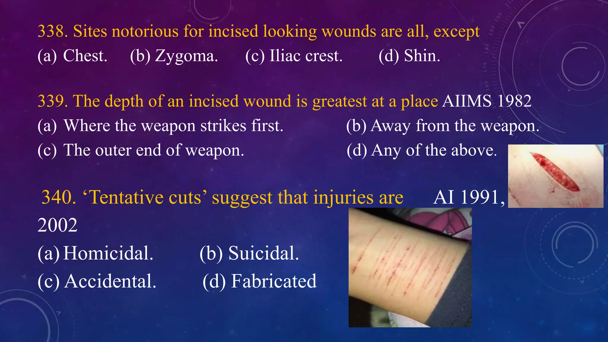 MCQ in MLI of wounds ppt | PPTX
