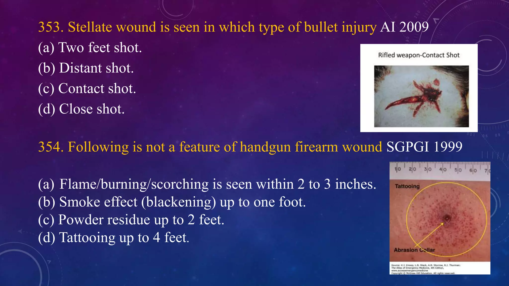 MCQ in MLI of wounds ppt | PPTX