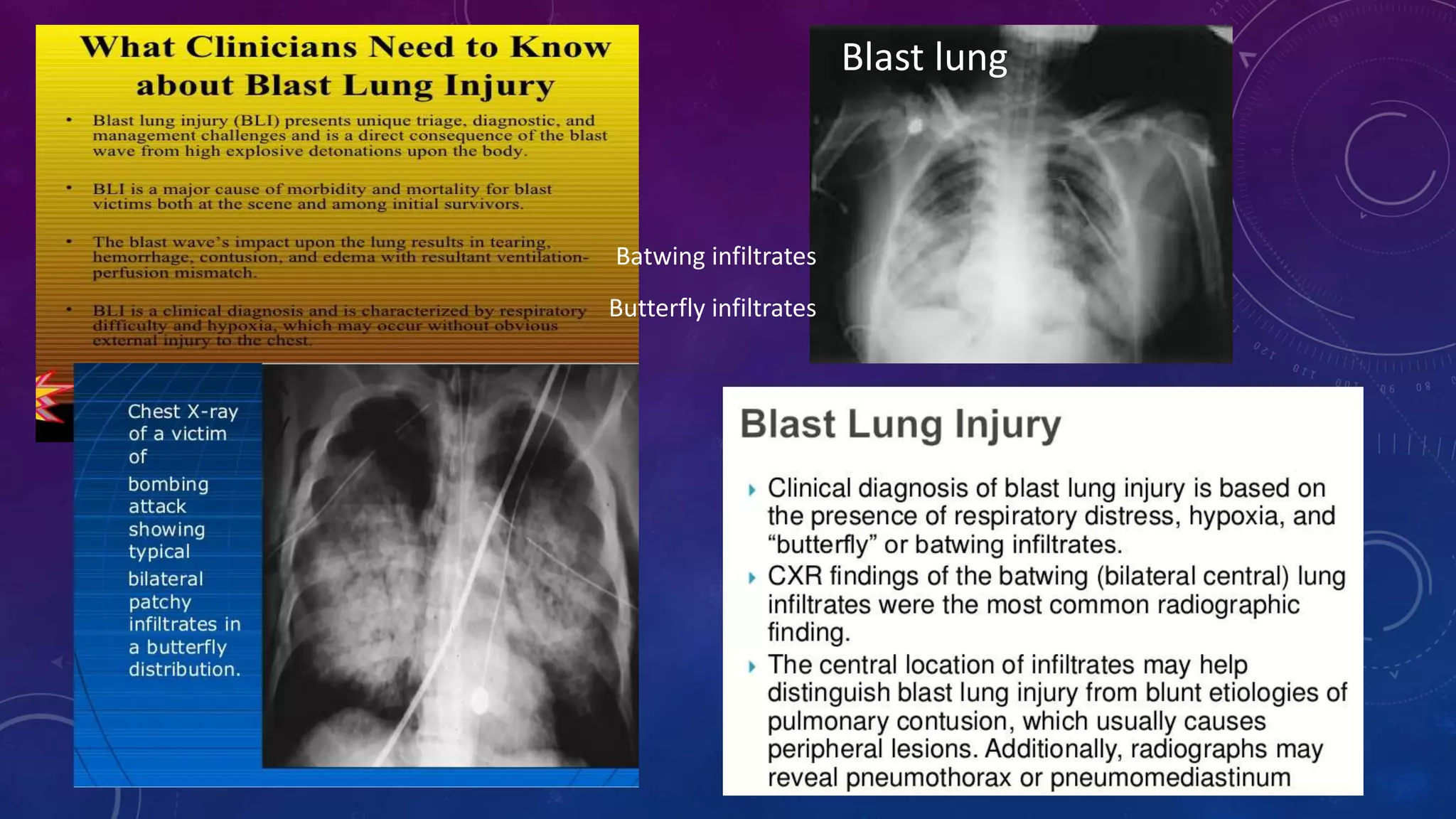 MCQ in MLI of wounds ppt | PPTX